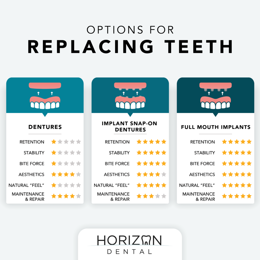 Teeth Replacement Options - Charlotte, NC - Horizon Dental